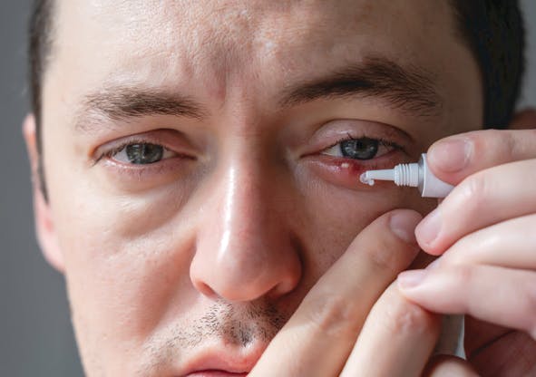 Breaking Down MGD Treatments Through the Lens of Sebaceous Gland ...