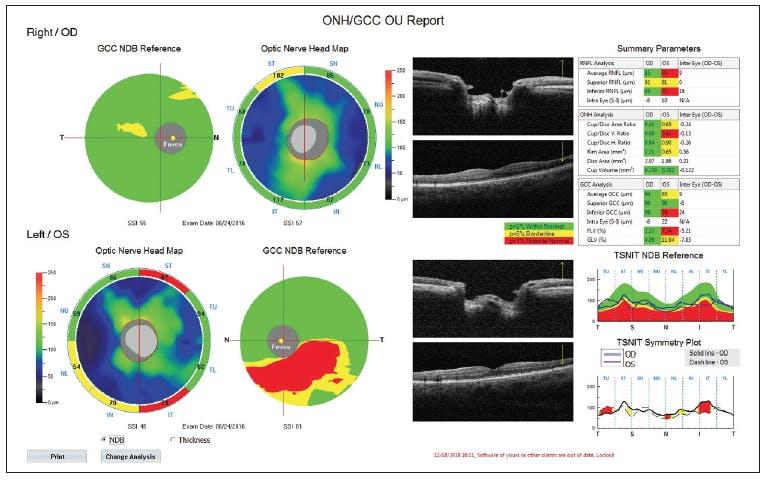 Xelpros Side Effects