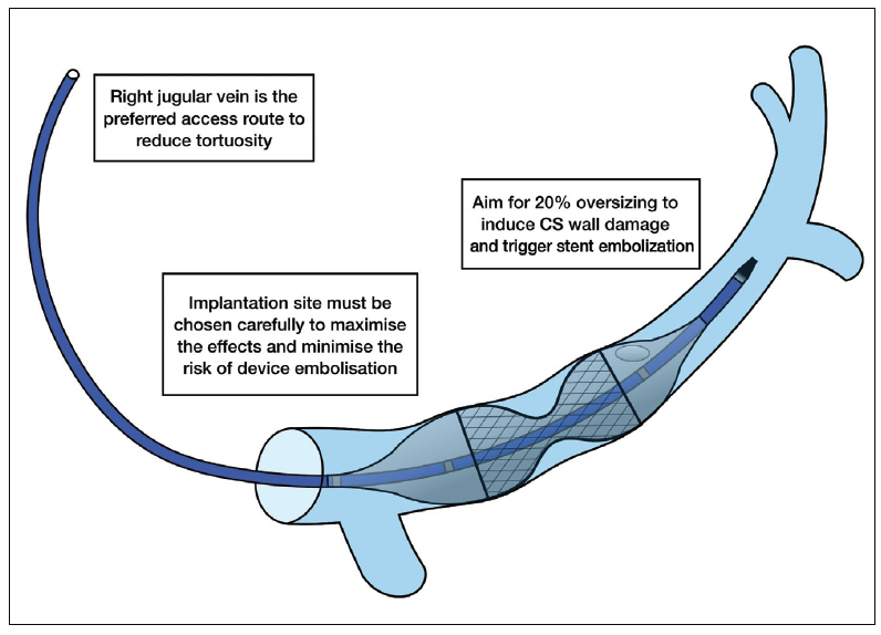 Novel Nonpharmacologic Therapies for Patients With Refractory Angina ...