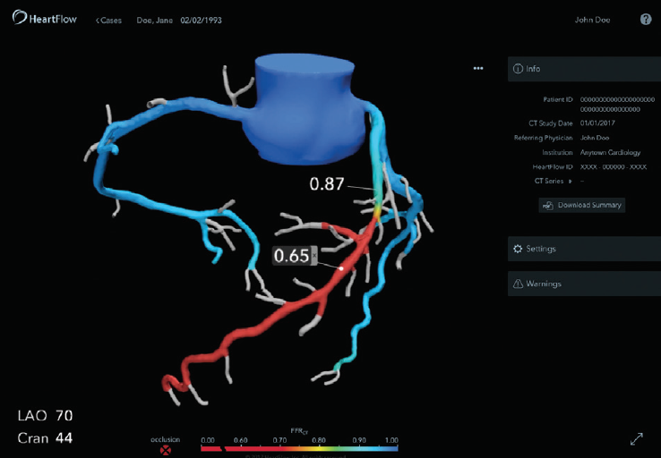 Applying Existing Technologies to Vascular Applications - Endovascular ...