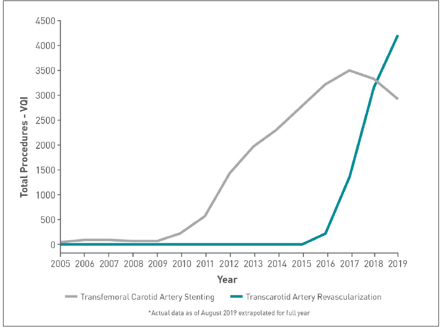 The Evolution of Carotid Artery Stenting: TCAR: Transcarotid Access and ...