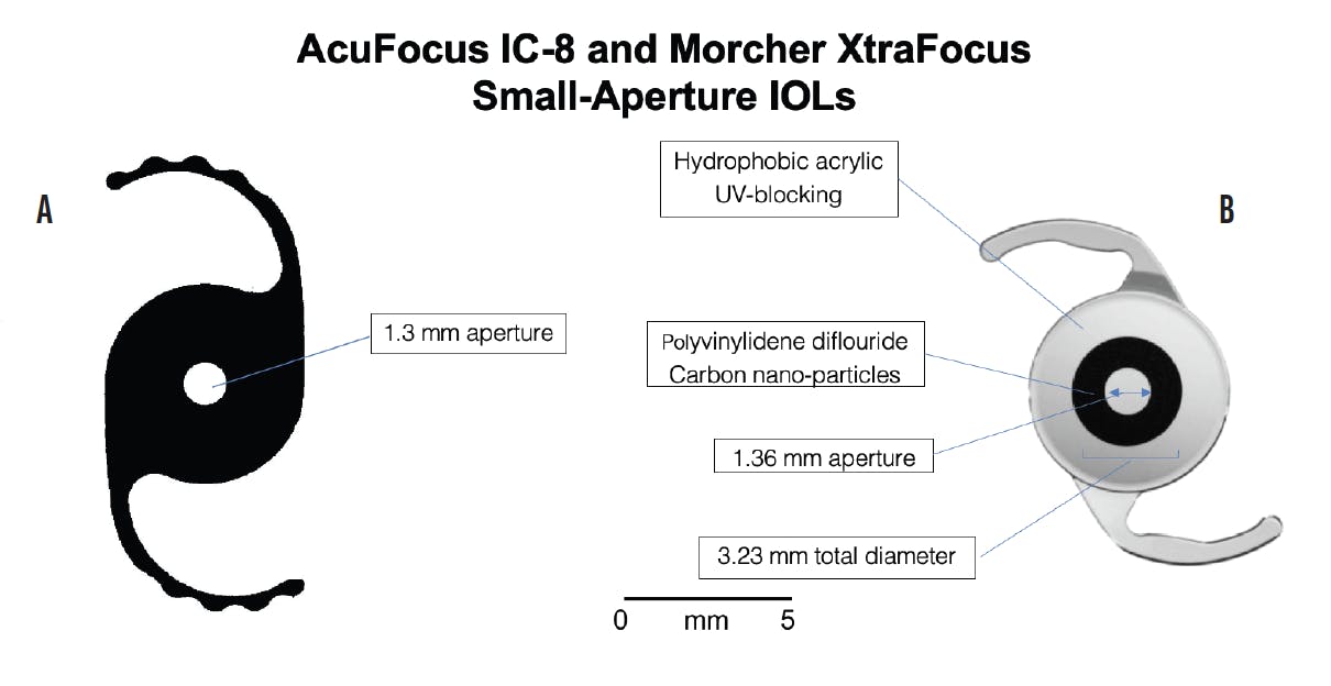 What Is the Optimal Pupil Size? - YoungMD Connect