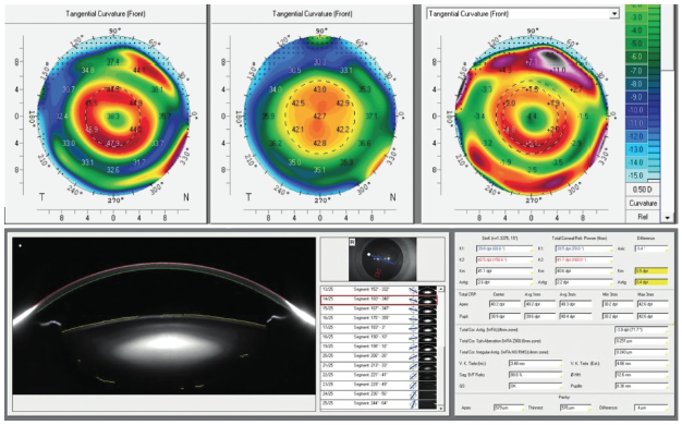 Barriers to the Business of Myopia Management - Modern Optometry