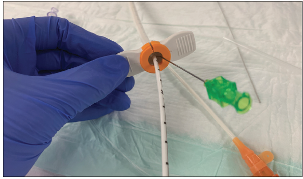 Single-Access Technique for Impella-Assisted High-Risk PCI - Cardiac ...