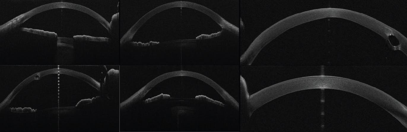 Deepfake OCT Imaging - YoungMD Connect