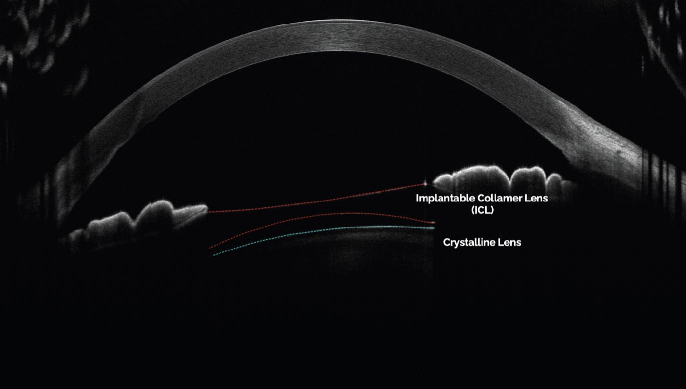 Deepfake OCT Imaging - YoungMD Connect