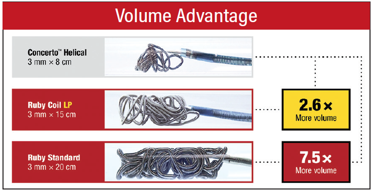 Penumbra’s Complete Embolization Platform Now With Low-Profile ...