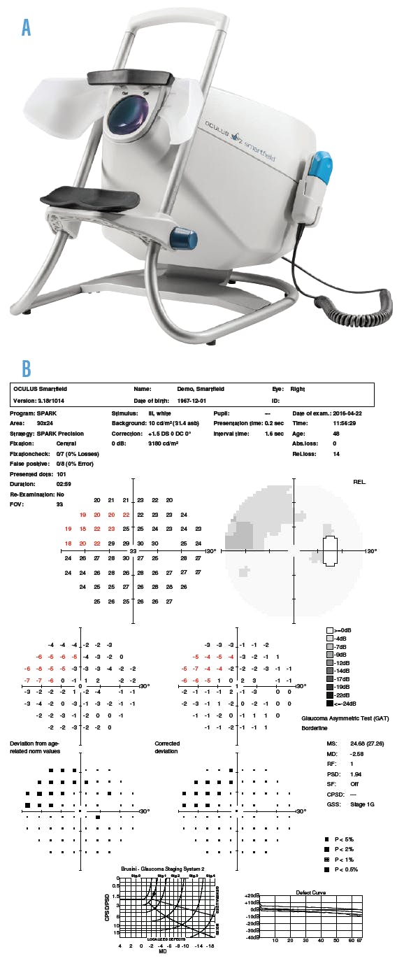 On Demand Perimetry - Modern Optometry