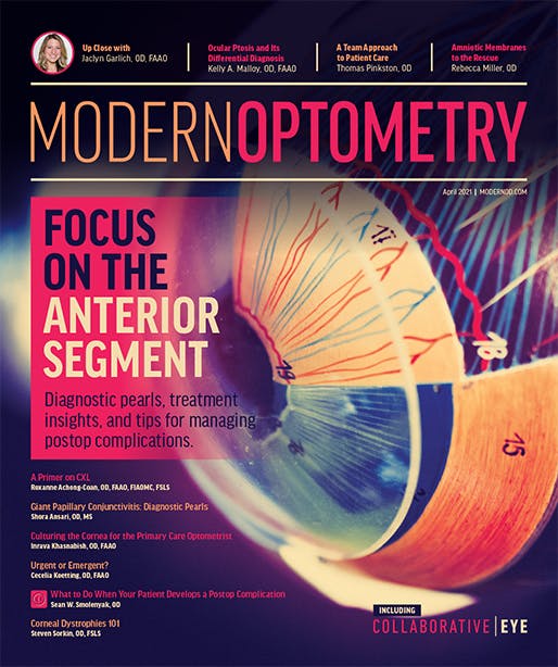 April 2021 Issue - Modern Optometry
