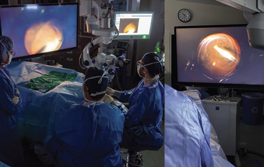 3D Heads-Up Display: Pearls for New Users - Retina Today