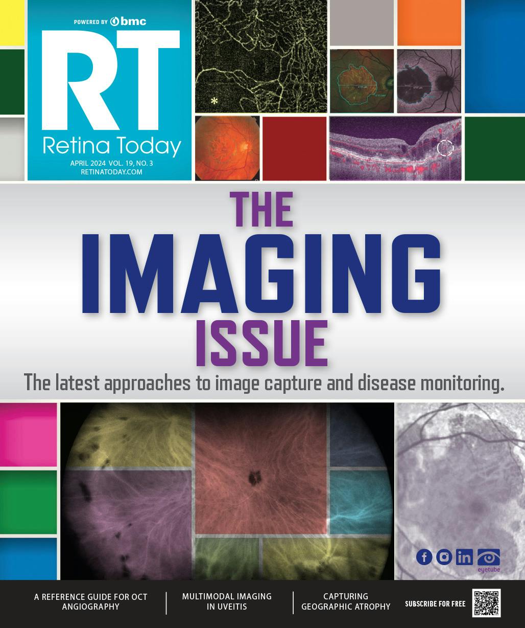 April 2024 Issue - Retina Today