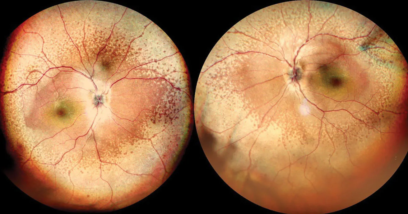 Pics Photos Retina Eye Anatomy: Parts Of The Eye & How Vision Works