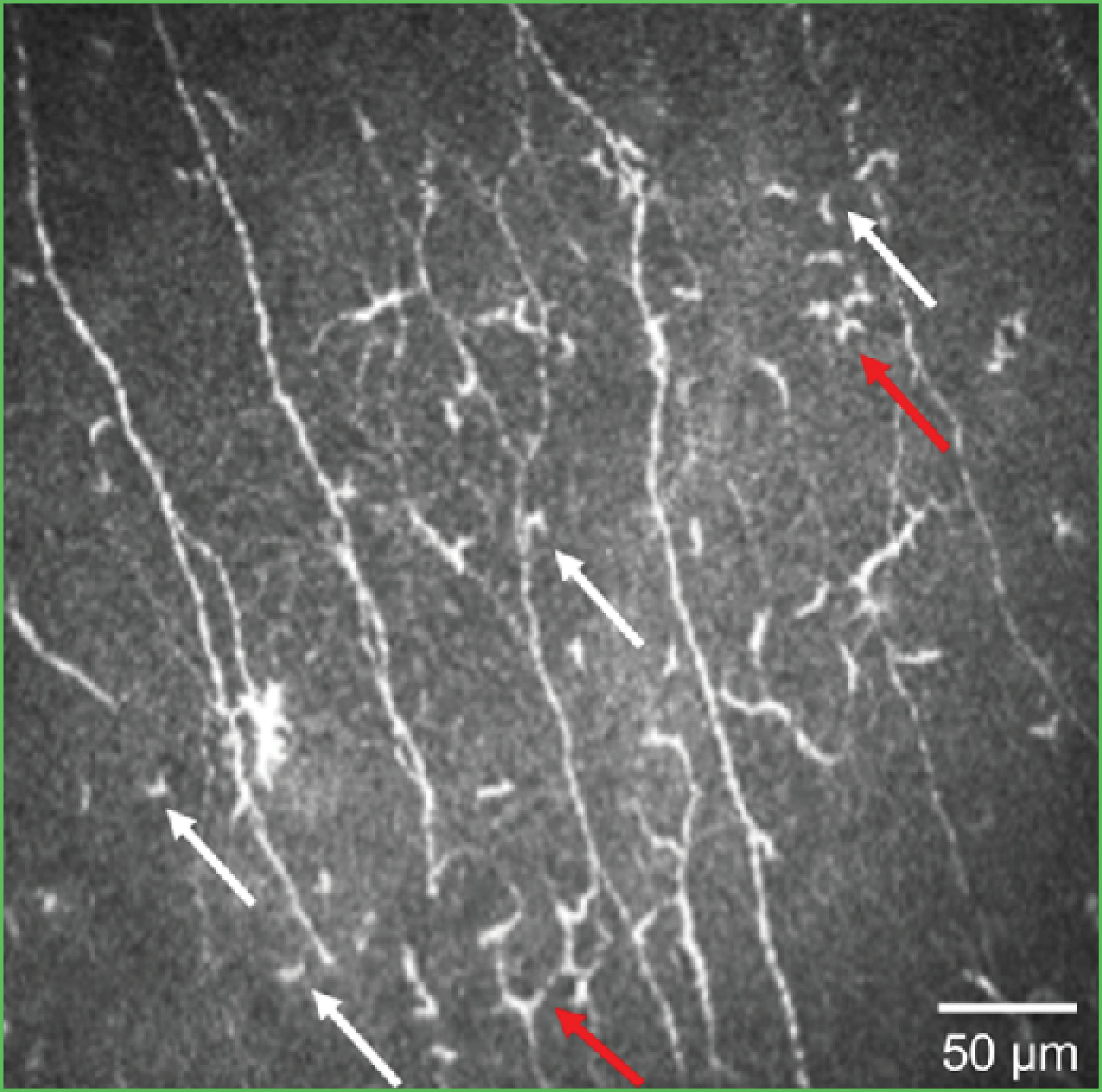 Scholarship Spotlight - YoungMD Connect