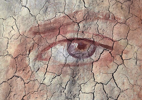 Essentials for Diagnosing OSD - Modern Optometry