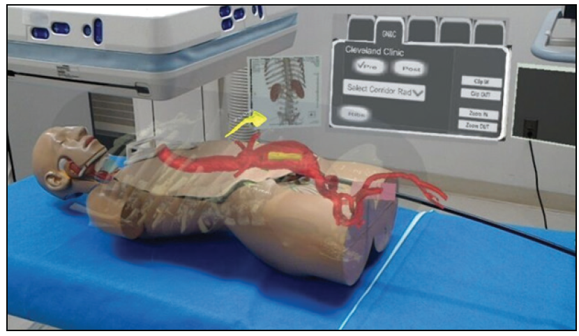 A Revolution of EVAR Imaging Technologies - Endovascular Today
