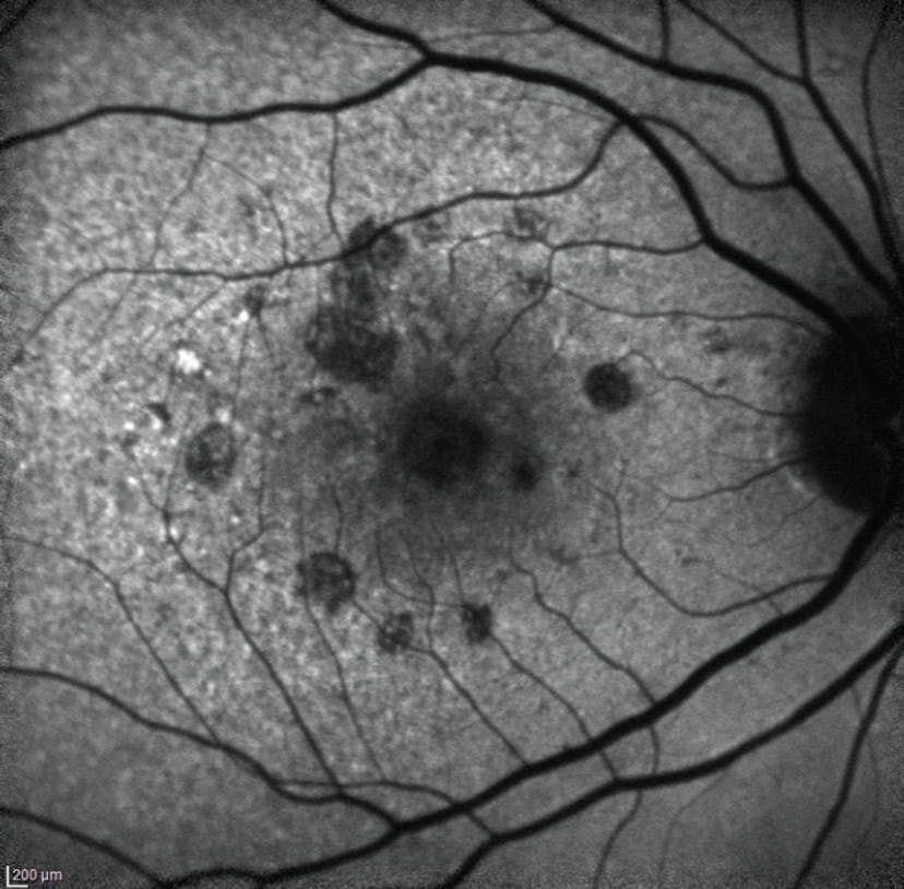Macular Research on the Move - Retina Today