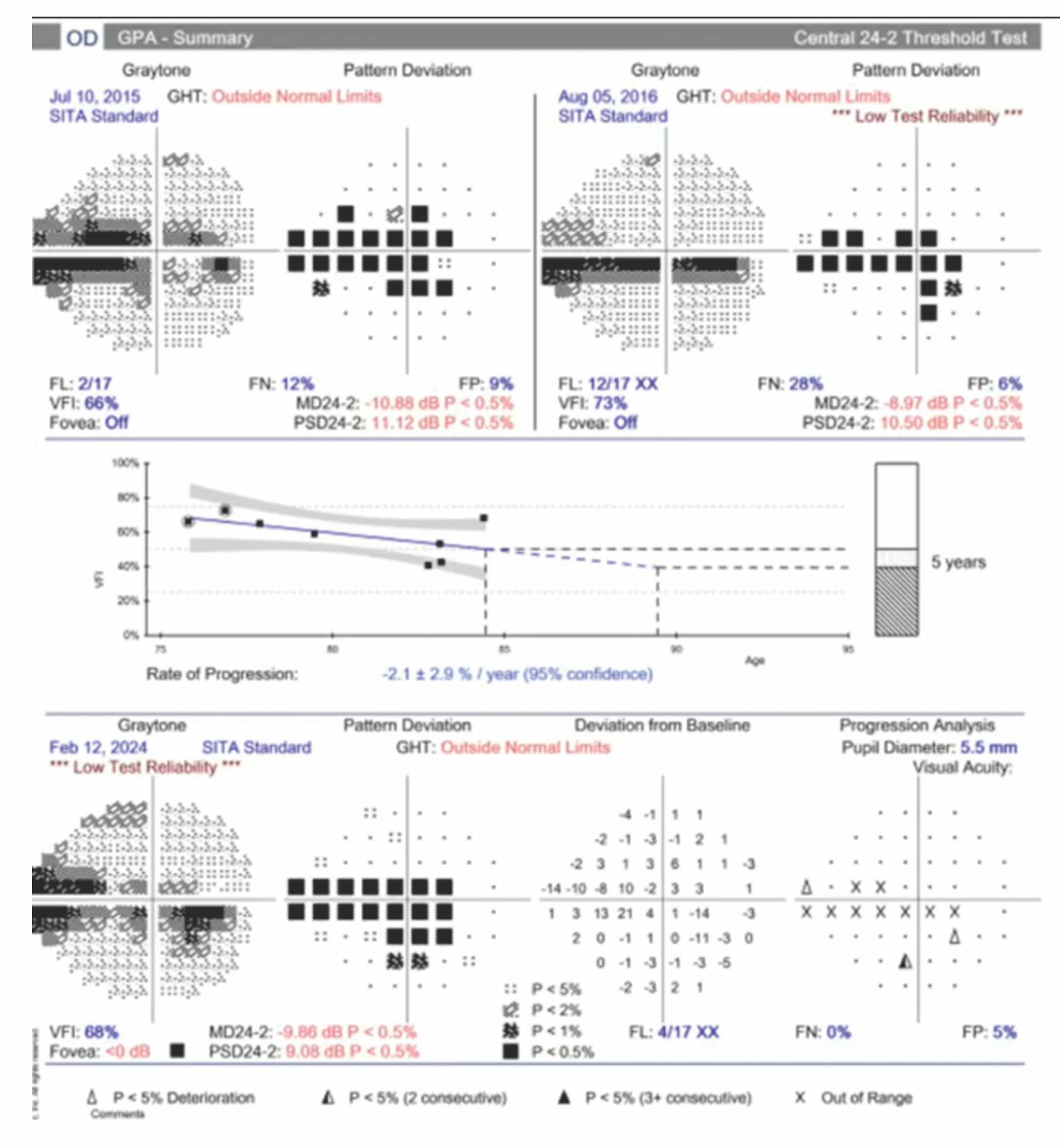 Staying Interventional Amid Resistance to Surgery - Glaucoma Today