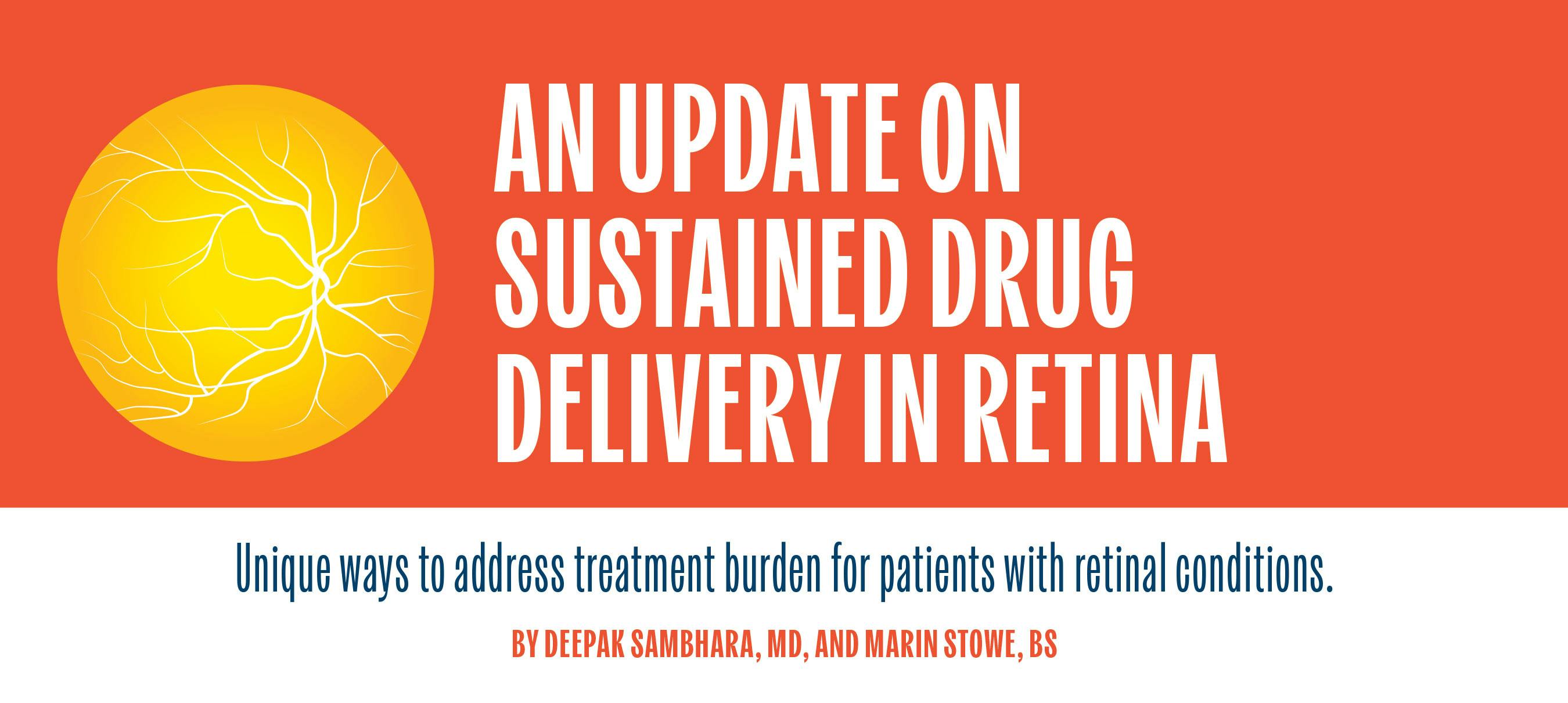 An Update on Sustained Drug Delivery in Retina - Retina Today