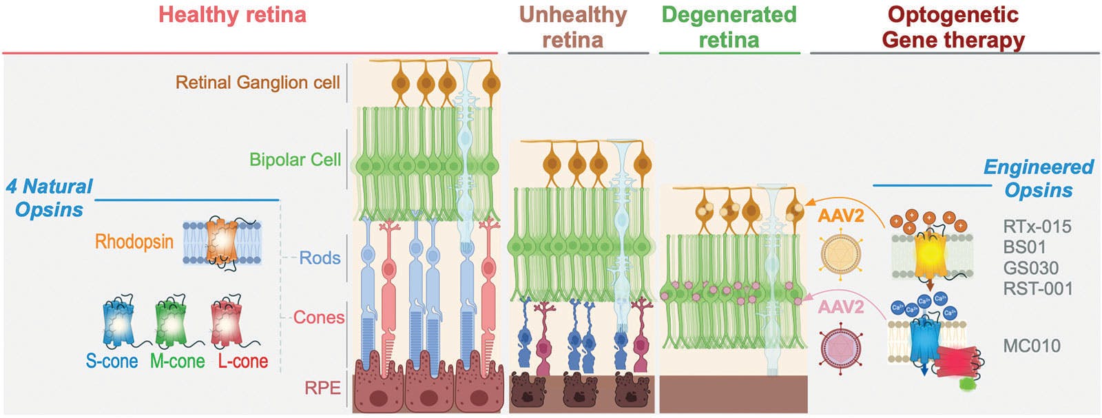 Optogenetics: Bringing Light to the Blind - Retina Today