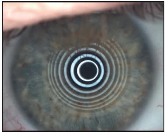 All-In-One Automated Measurement of Ocular Surface Parameters - Modern ...