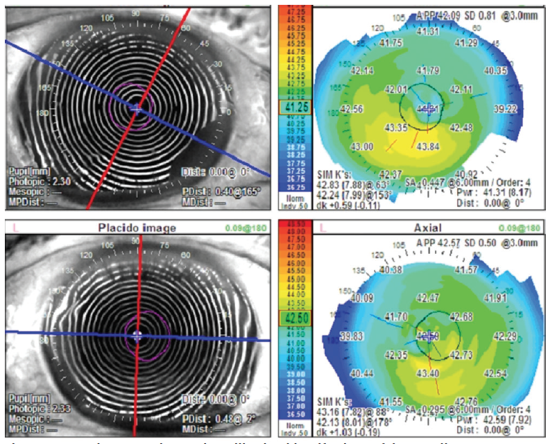 Updates In Dry Eye Disease: Diagnosing and Treating Patients with ...