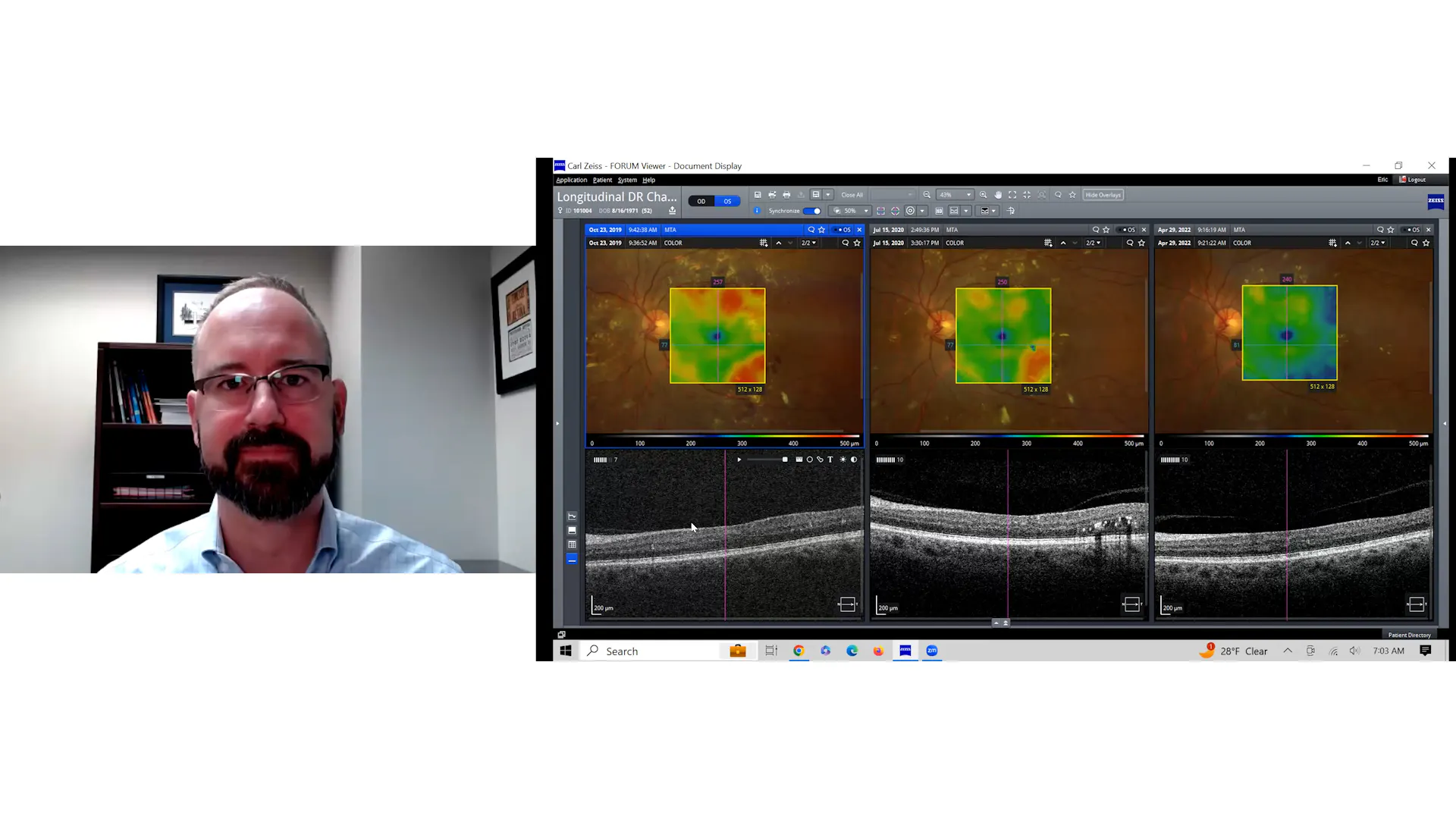 ZEISS Retina Workflow: How to use multi-modal imaging for Diabetic ...