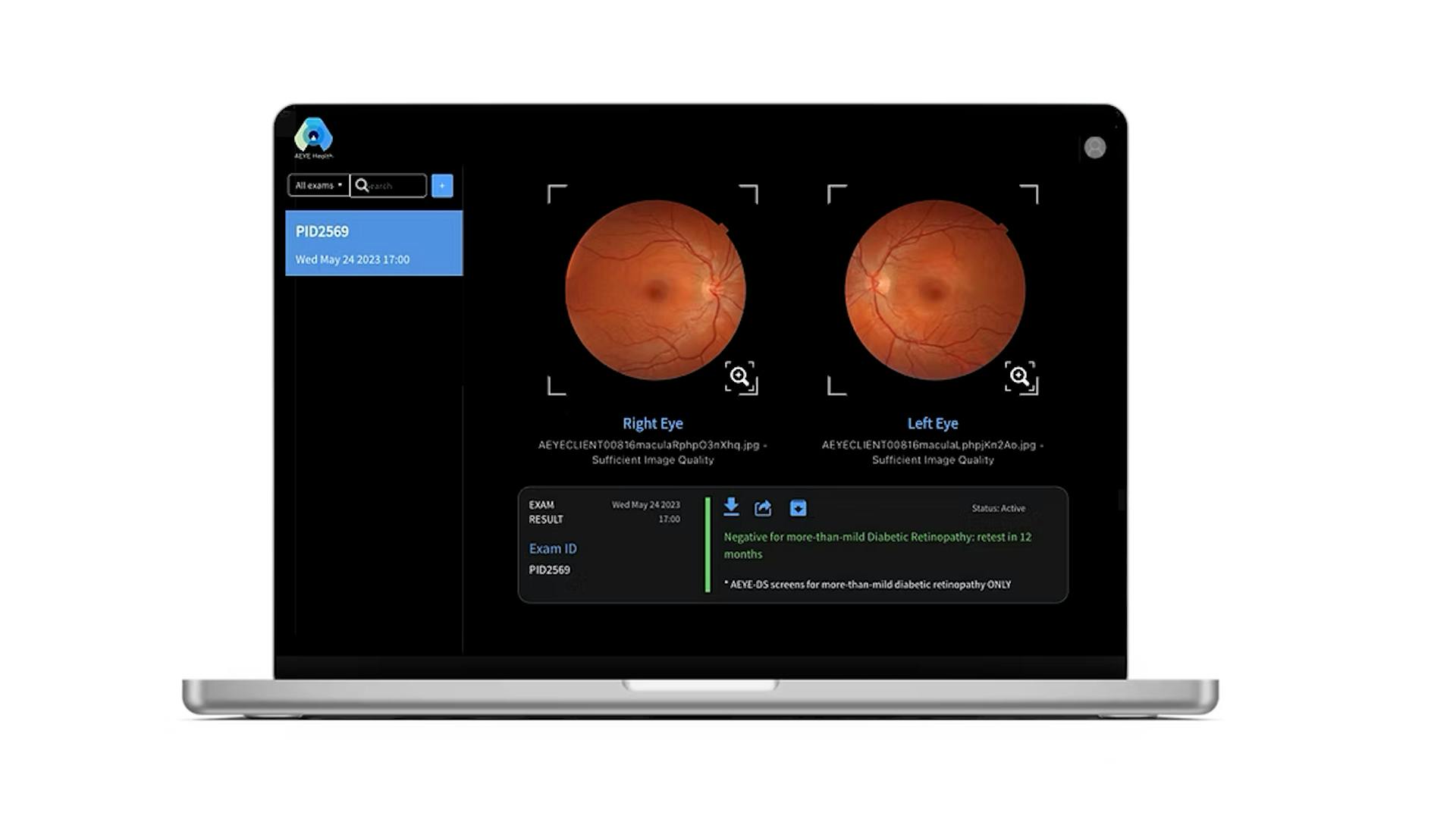 AI Moving Forward - Eyewire+