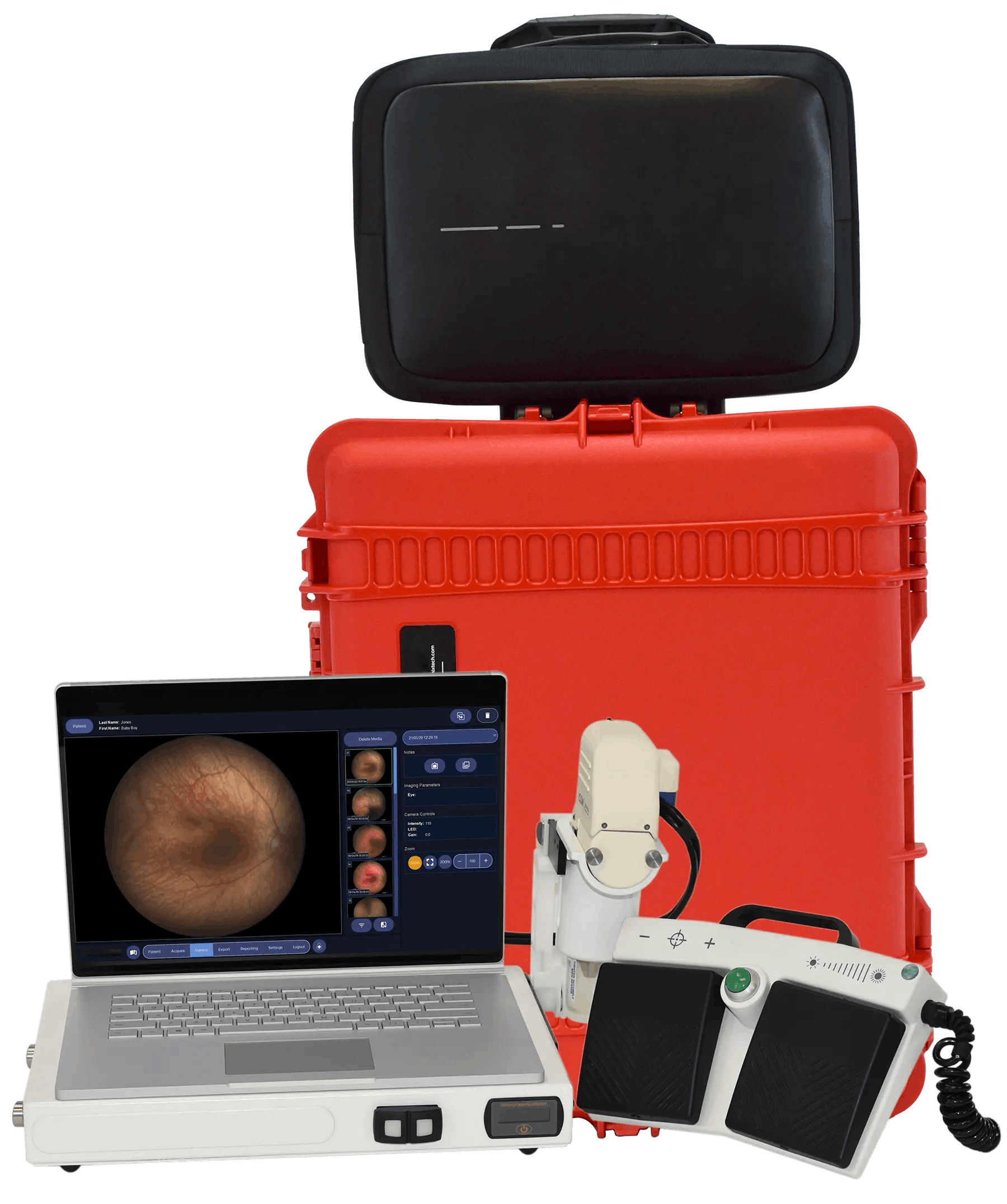 NeoLight’s Icon Go With Fluorescein Angiography Capabilities Cleared by ...