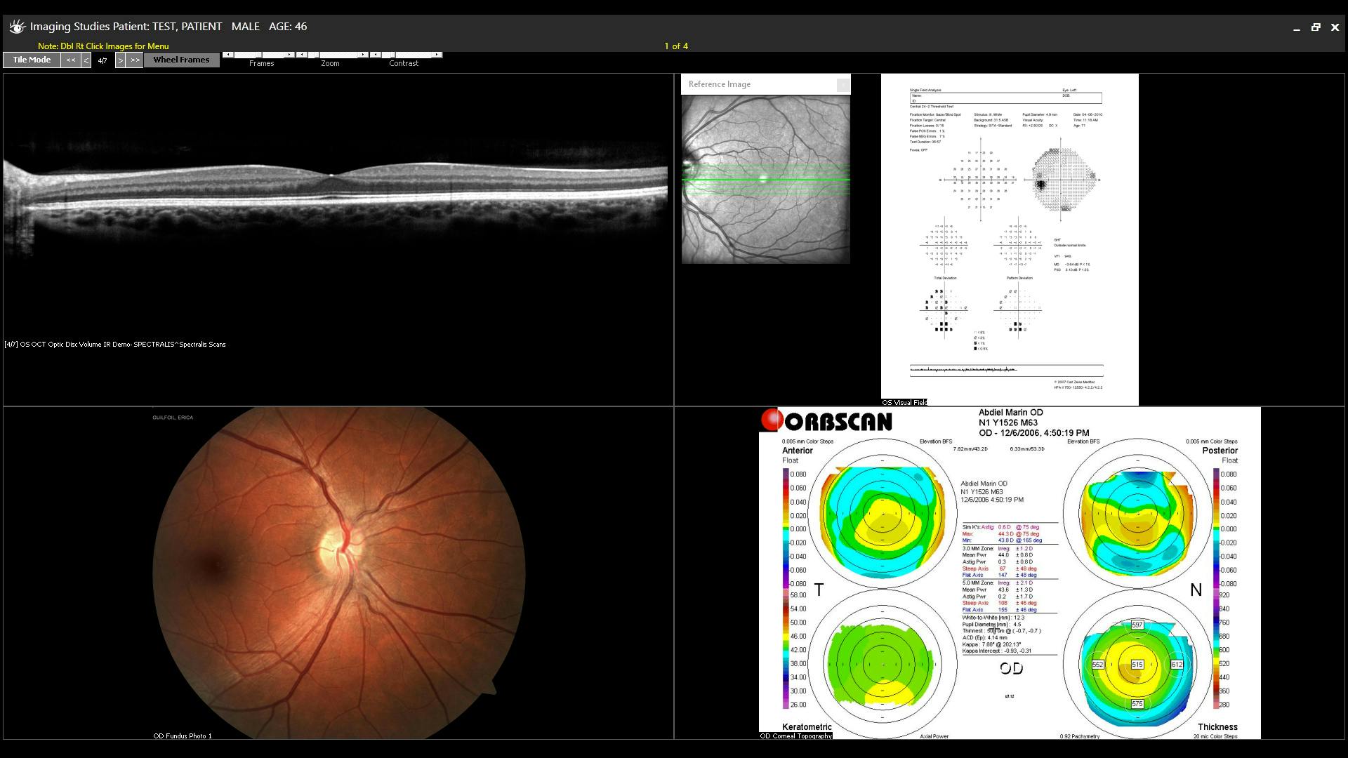 EyeMD EMR Edge Computing - Eyewire+