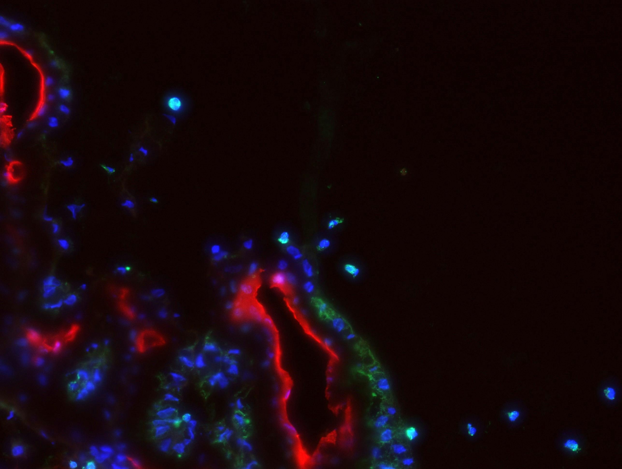 Novel Imaging Technology Reveals Role of Immune Cells in Early Diabetic ...