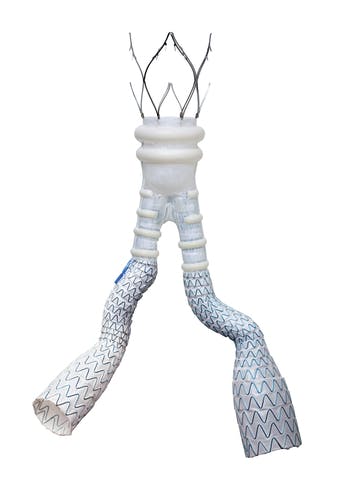 Endologix Alto Abdominal Stent Graft’s 12-Month ELEVATE IDE Trial ...