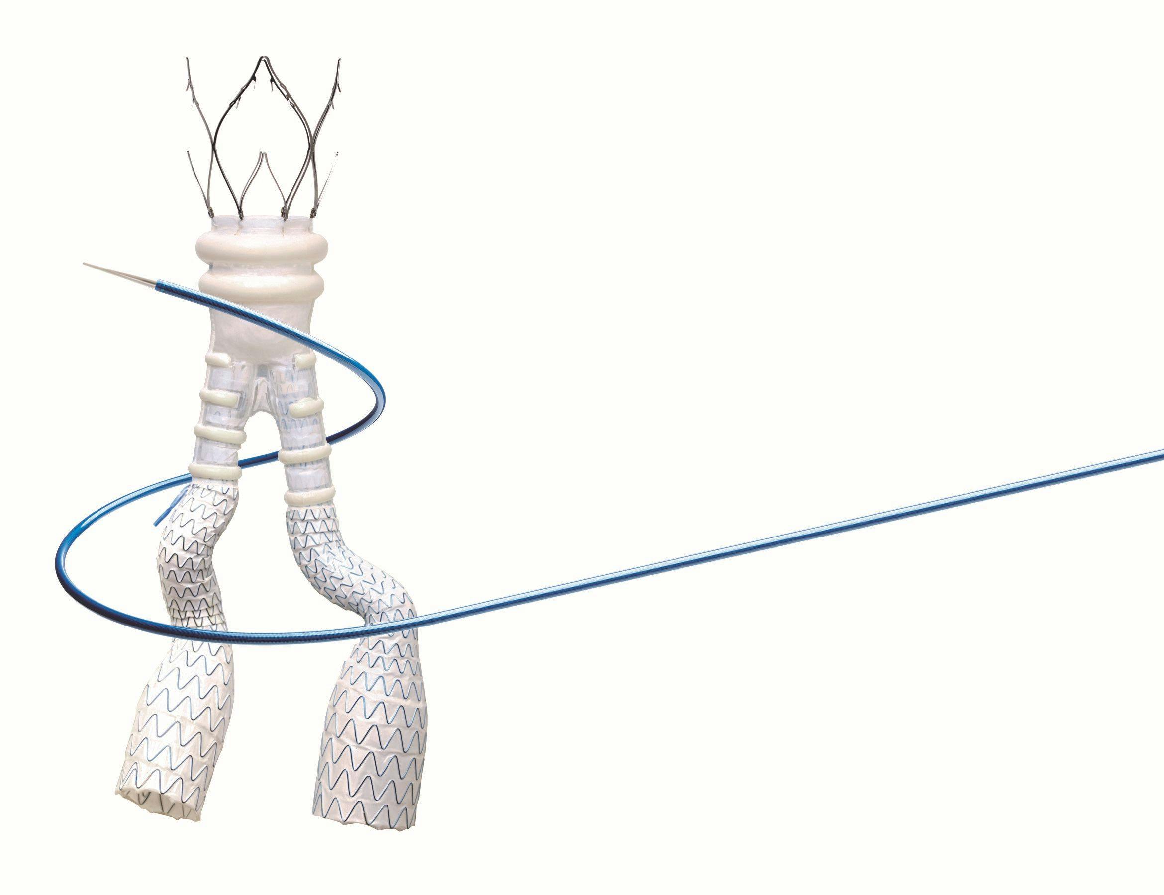 Endologix Launches Alto EVAR System in Europe - Endovascular Today