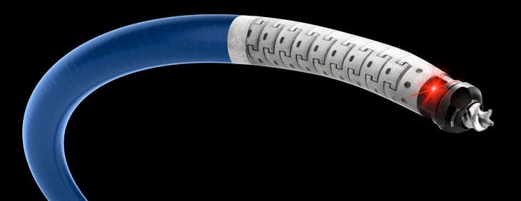 Avinger’s Tigereye ST Image-Guided CTO Crossing System Cleared by FDA ...