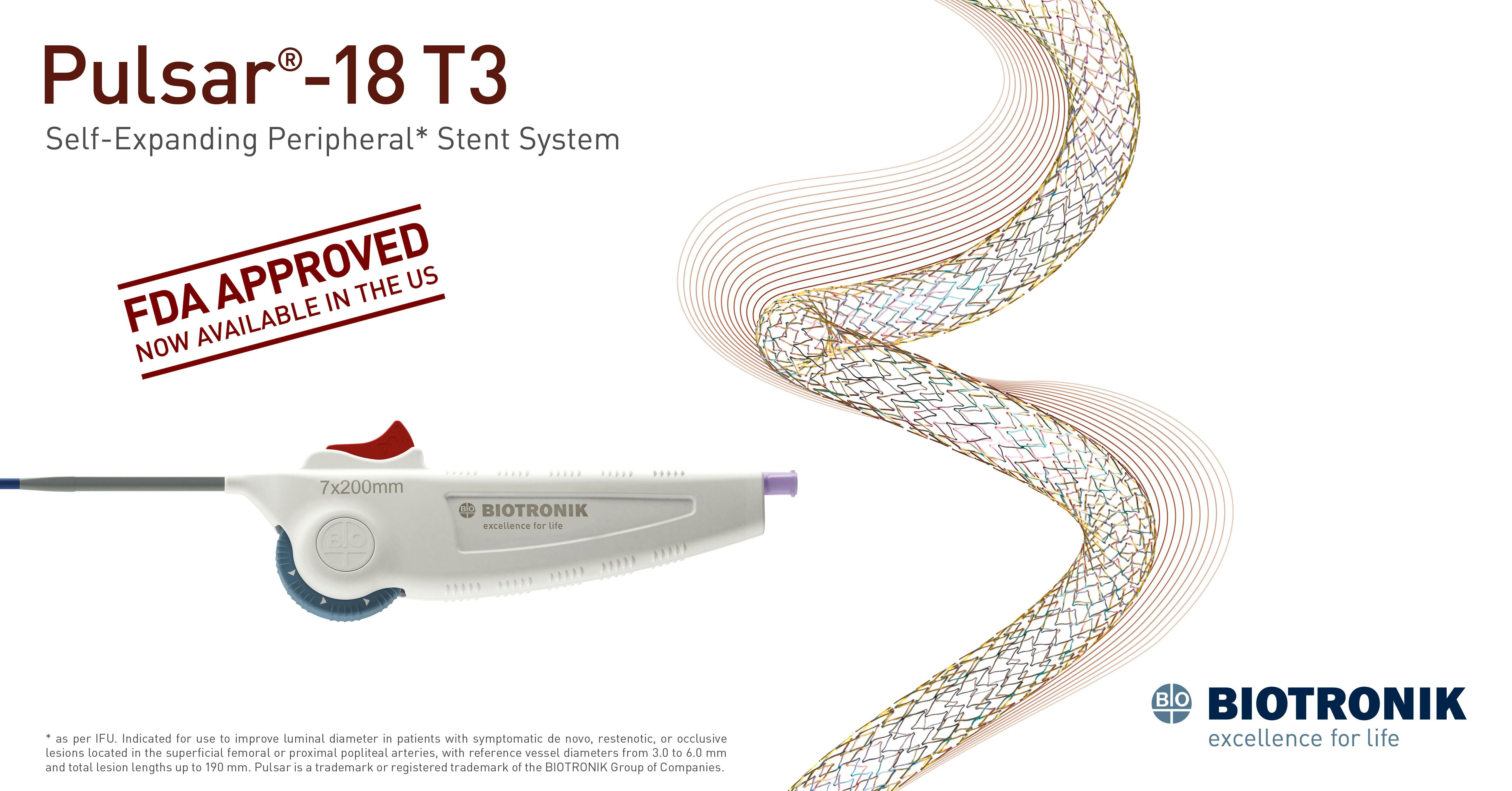Biotronik’s Pulsar-18 T3 Tri-Axial 4-F Self-Expanding Stent System ...