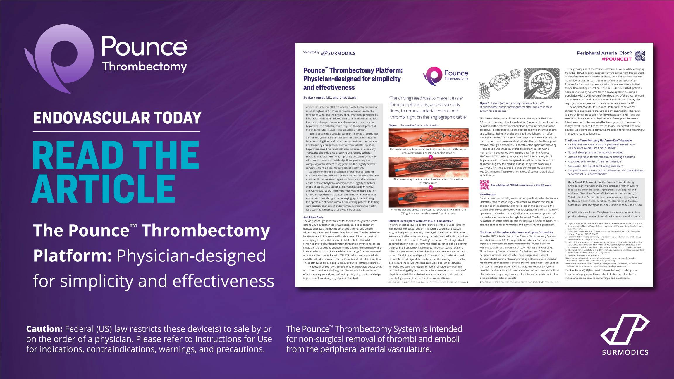 Pounce™ Thrombectomy Platform: Physician-designed for simplicity and ...