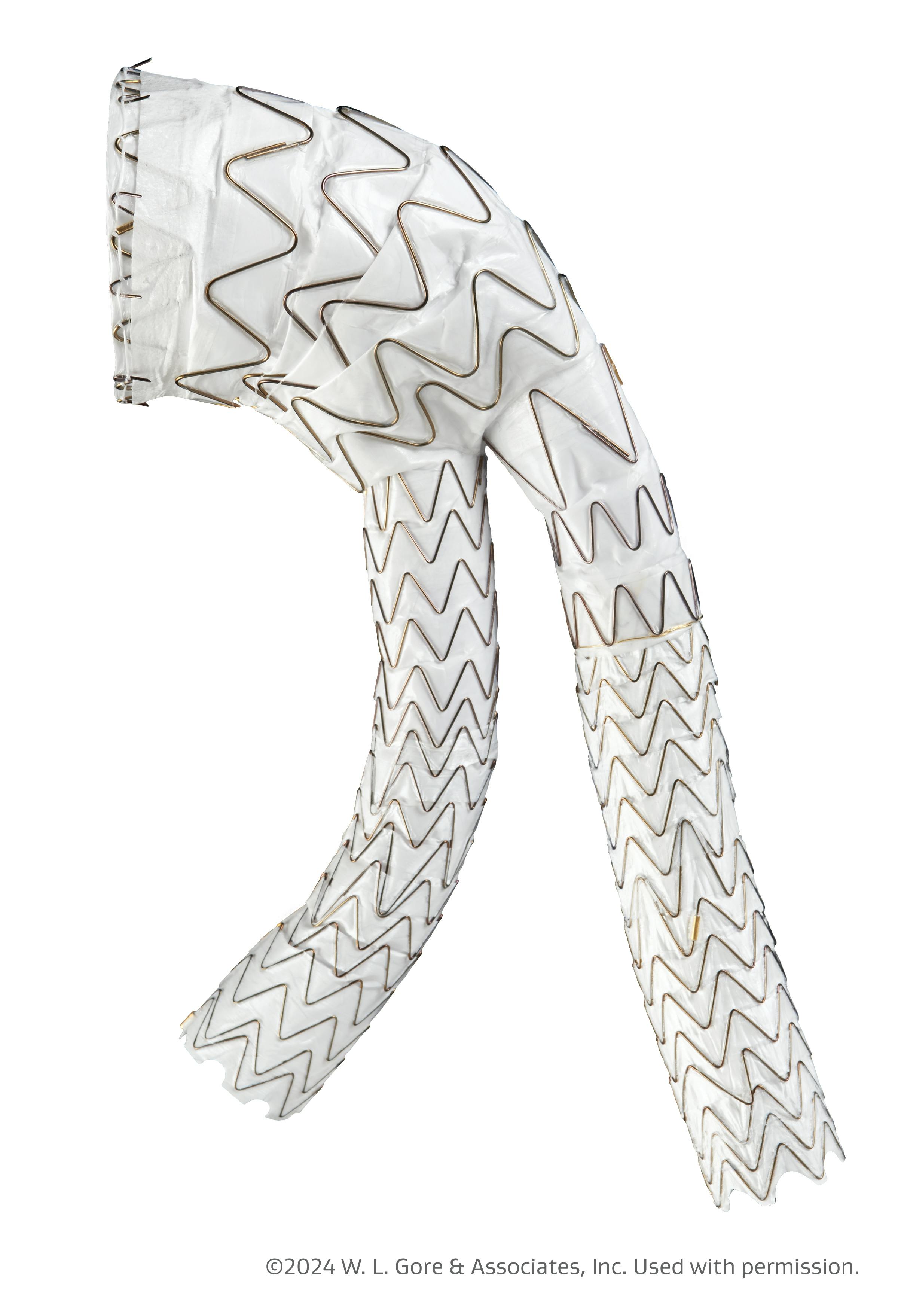 Gore’s Excluder Conformable AAA Endoprosthesis Approved for Expanded ...