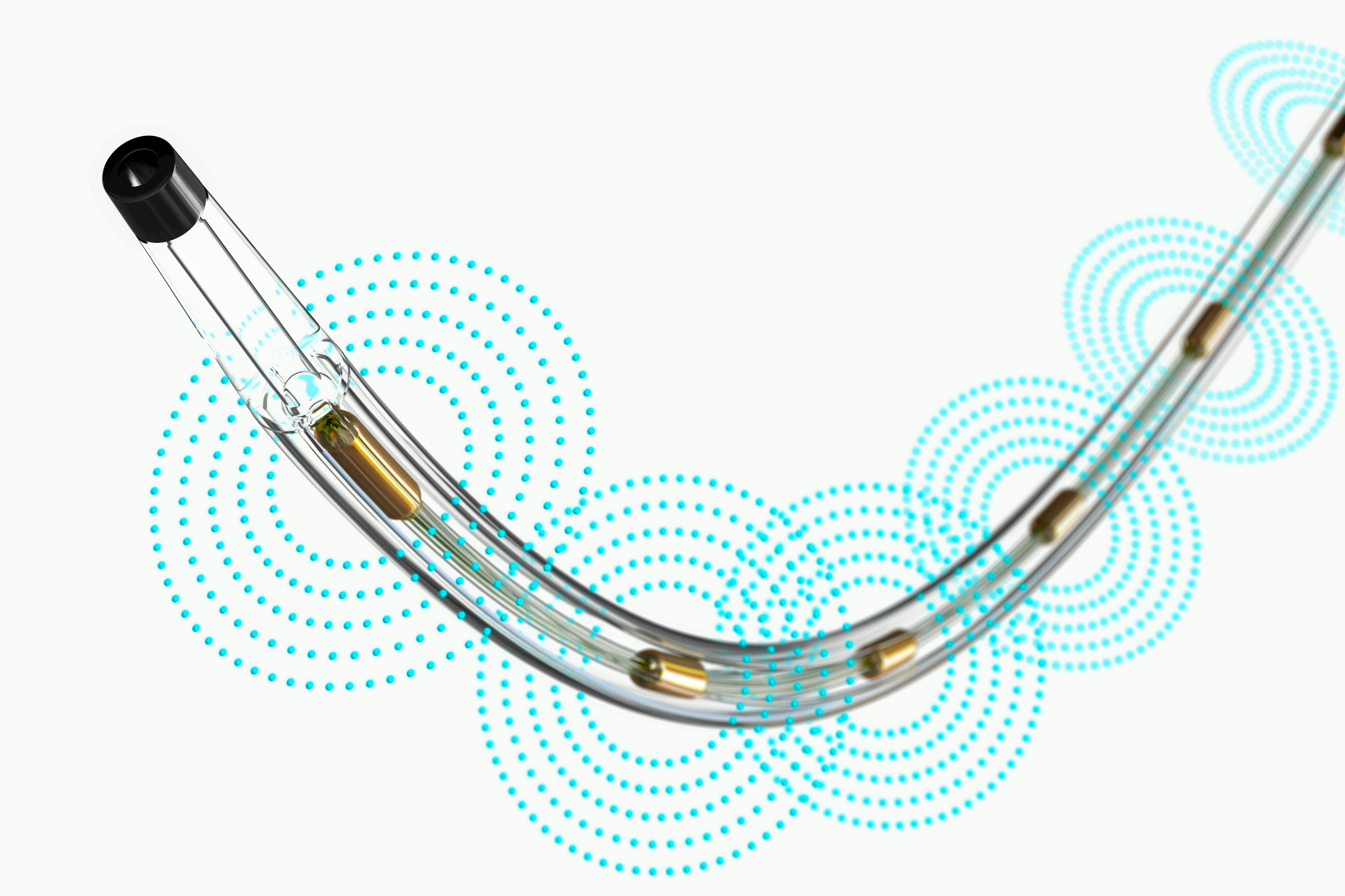 Boston Scientific’s Ekos System Compared With Mechanical Thrombectomy ...