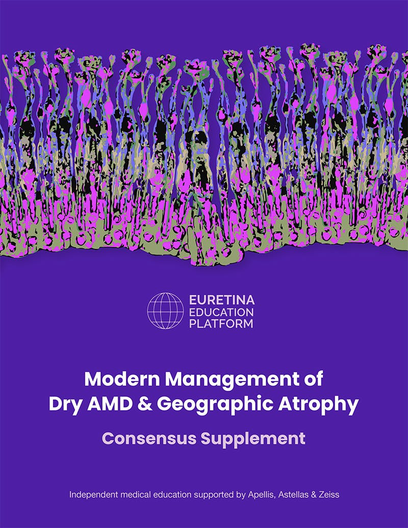 Photobiomodulation as a Treatment in Dry AMD - Retina Today