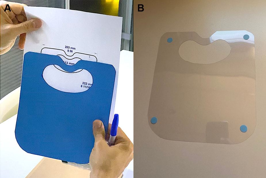 Slit-Lamp Droplet Shield - Modern Optometry