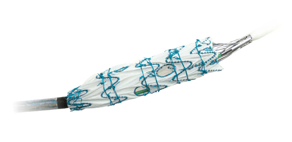 Terumo Aortic’s Fenestrated Treo Abdominal Stent Graft System Granted ...