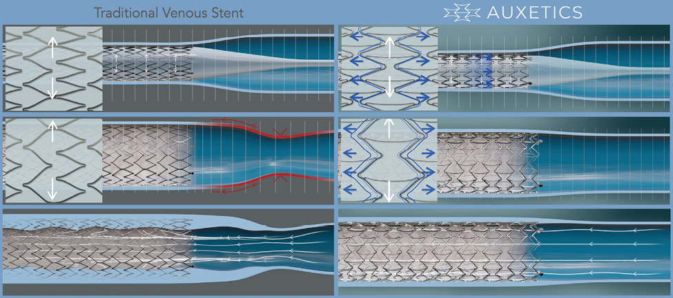 The Innovative Journey of Auxetics: How a Simple Observation Led to a ...