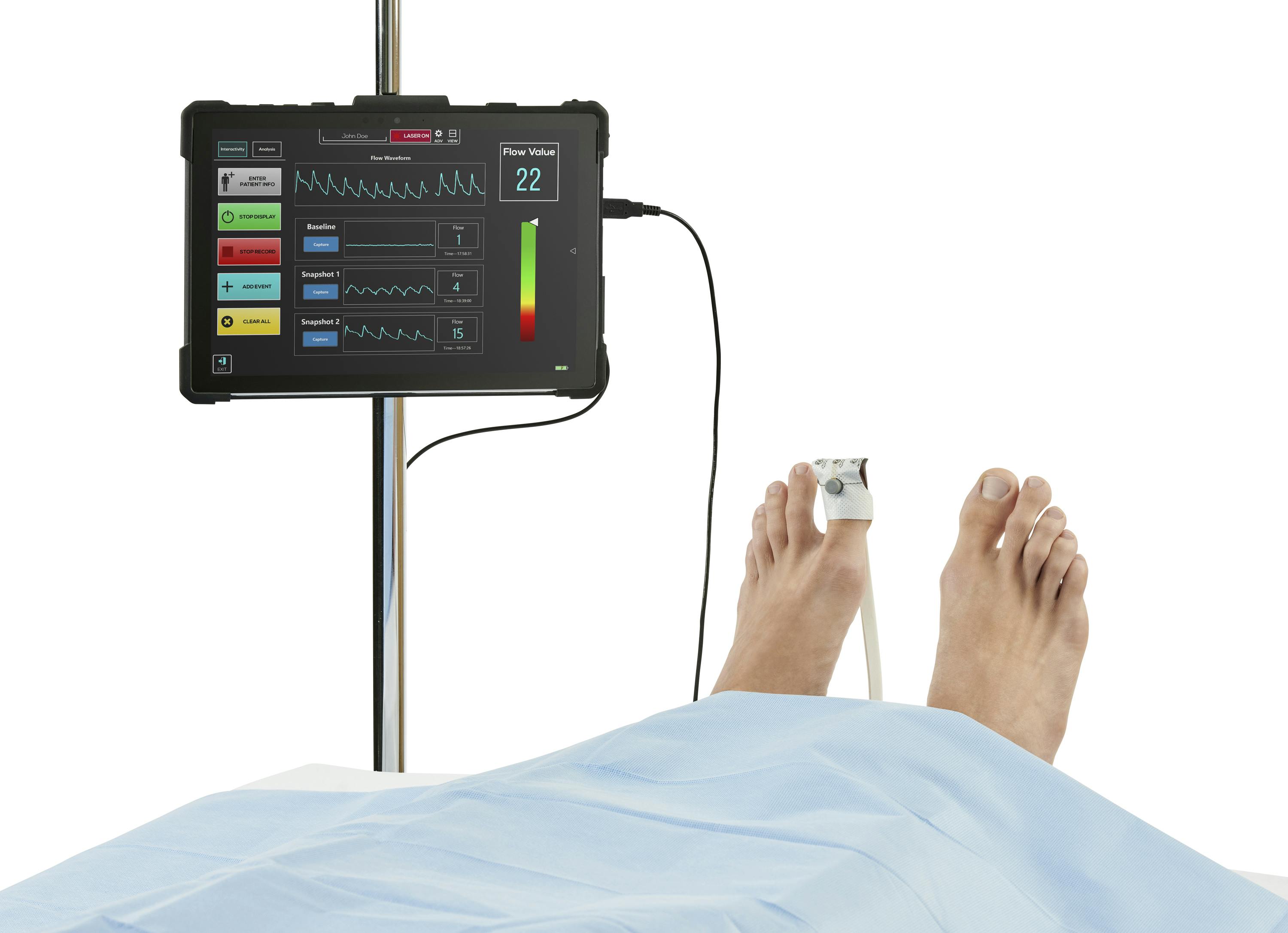 Medtronic’s FlowMet Peripheral Blood Flow Monitoring System With a ...