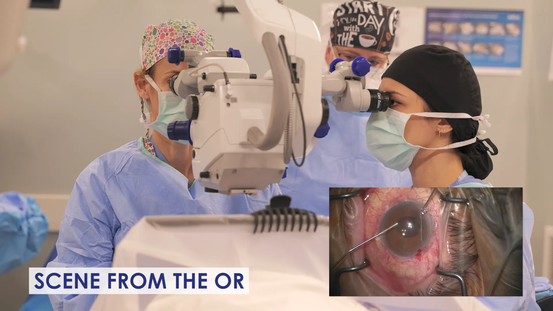 Optimizing Existing Tube Shunt in Uveitic Glaucoma - Eyetube