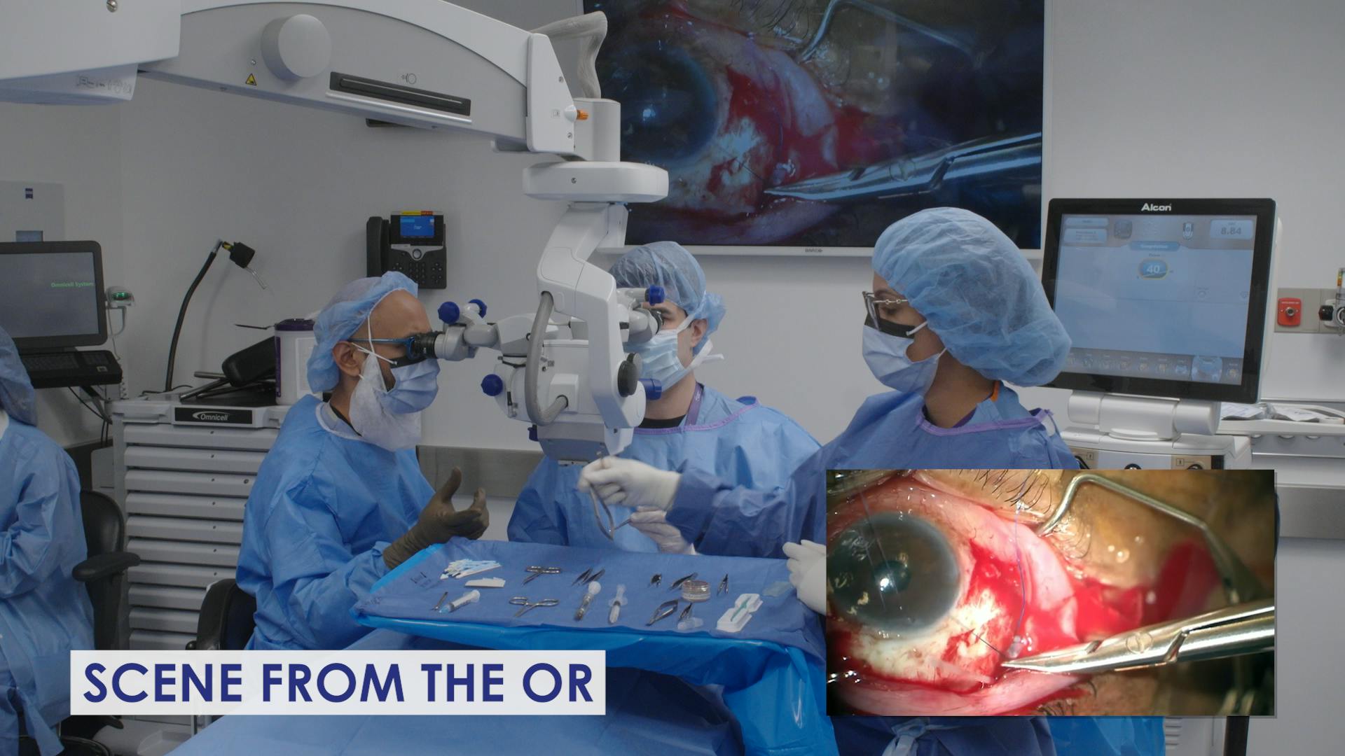Surgical Approaches for Ahmed Glaucoma Valve Implantation - Eyetube