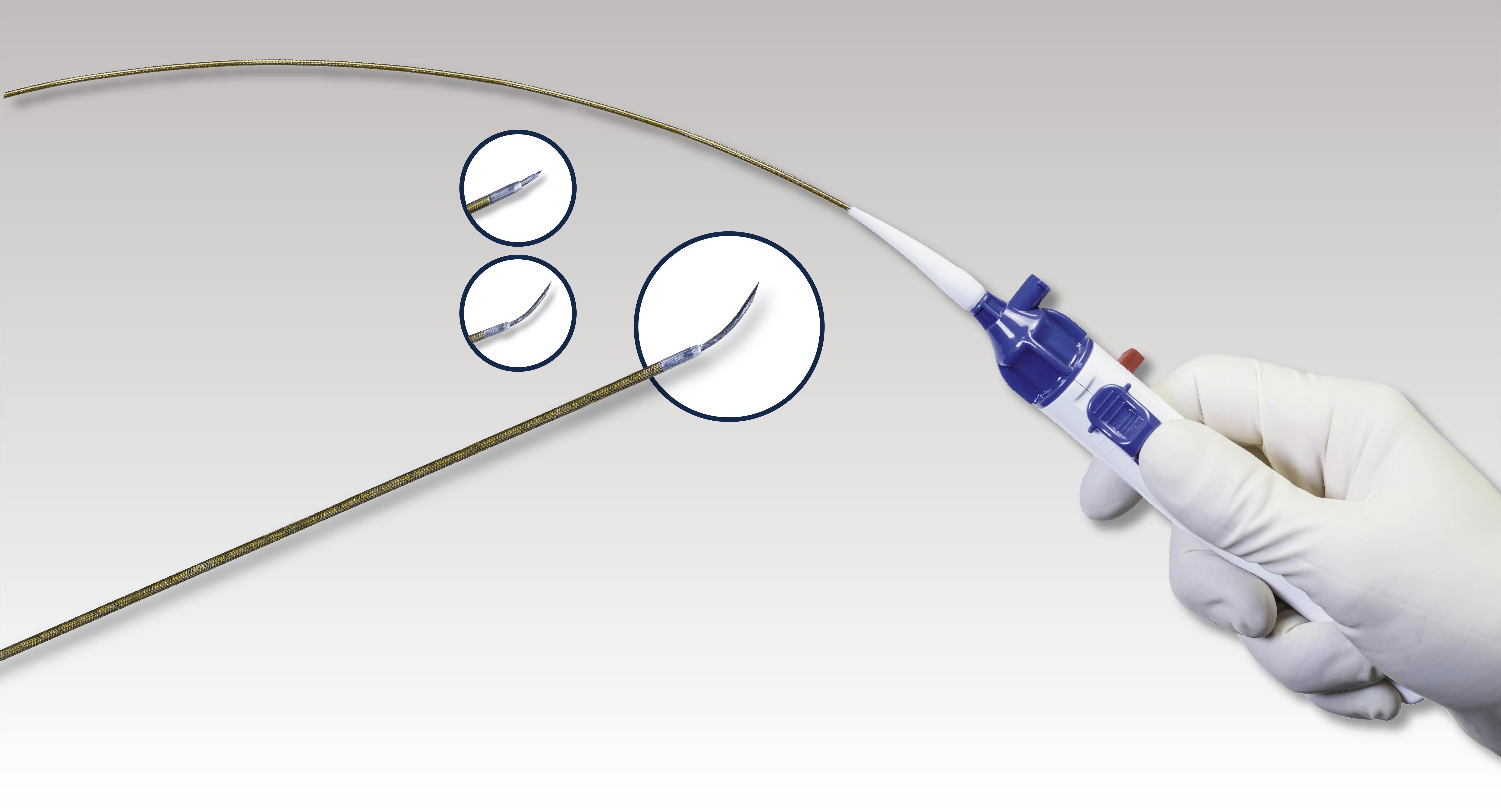 Upstream Peripheral’s GoBack Catheter Found to be Effective in Crossing ...