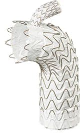 Gore TAG Thoracic Branch Endoprosthesis Gains FDA Approval ...