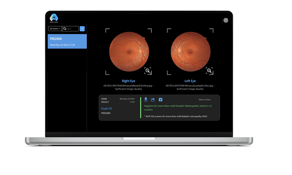 FDA Clears AEYE Health's Autonomous AI for Portable Diabetic ...