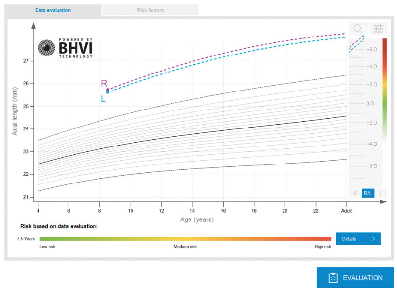 Monitoring Myopia Progression With the Myopia Master® - Modern Optometry