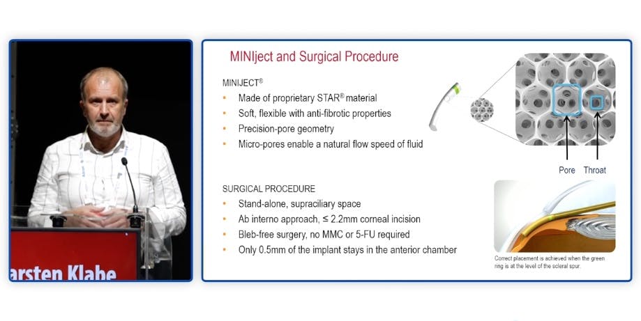 Patient Selection With MINIject: Who Can Benefit From Supraciliary MIGS ...