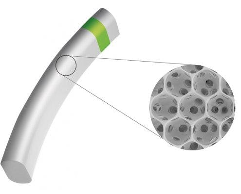 iSTAR Medical Receives European Market Approval for Glaucoma Implant ...